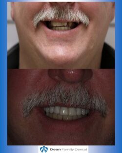 Home - Dean Family Dental